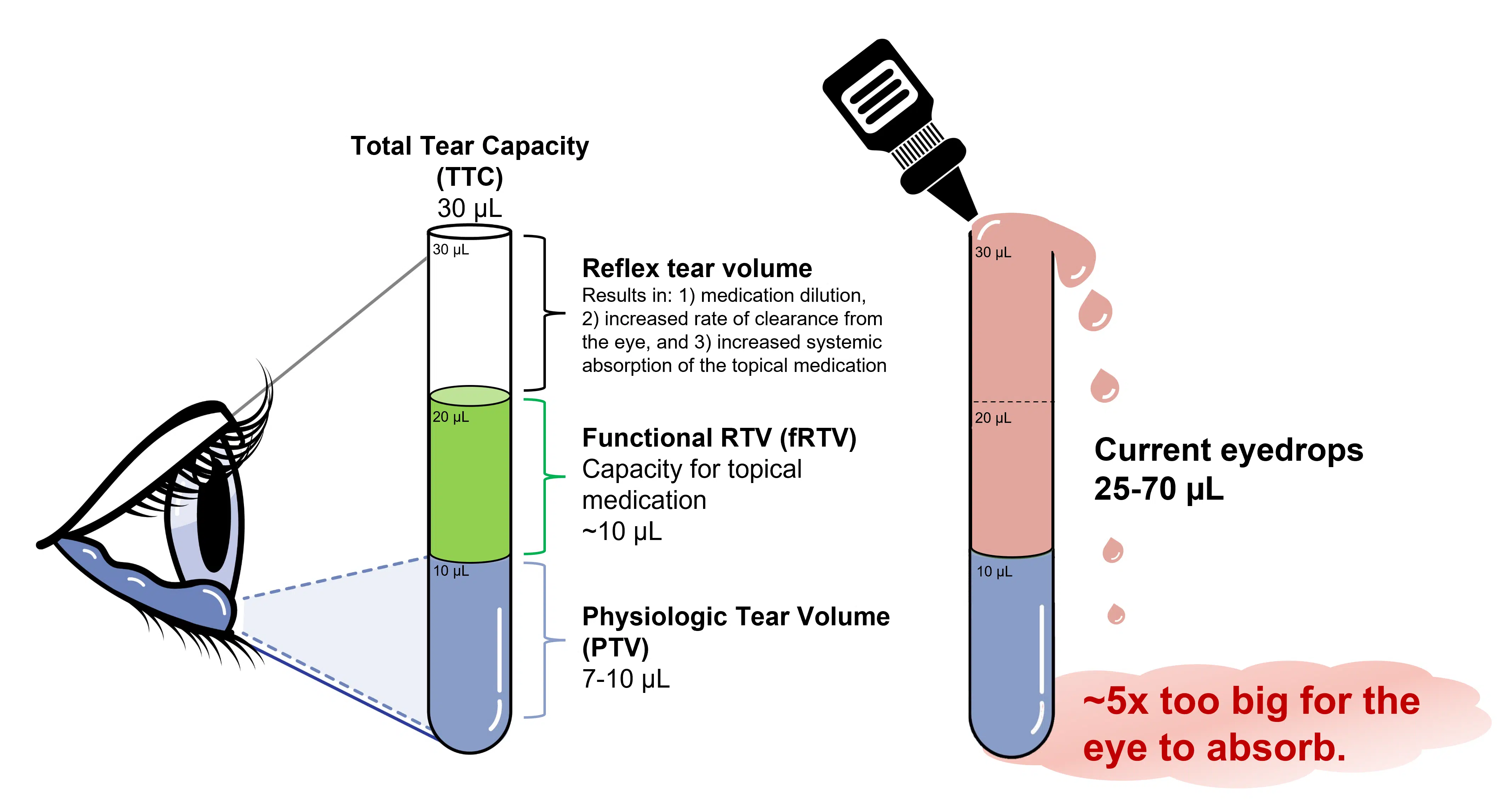 How Many Drops Are in Your Eyedrop Bottle? Why It's Vital To Know ...